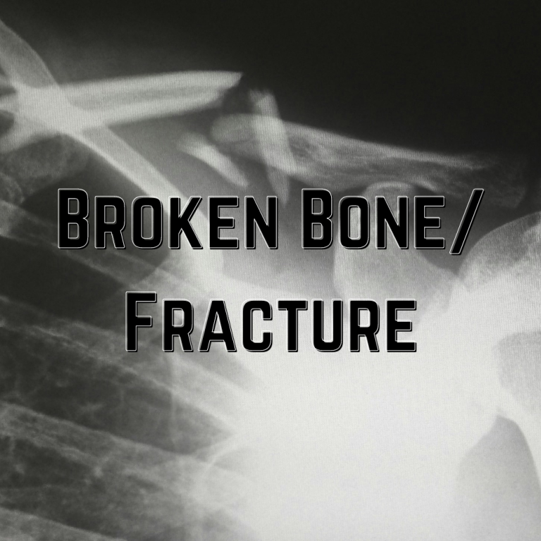 Broken Bone/Fracture recipe - Herbs and Curves